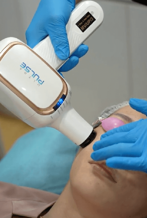 Ultra PicoPulse - Ultra Picopulse - Advanced Skincare Technology | One Doc